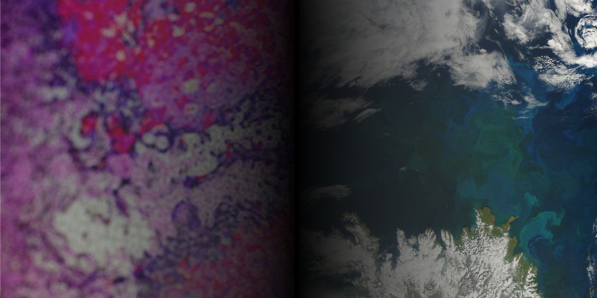 Improving The Generalizability Of Histopathology Classification