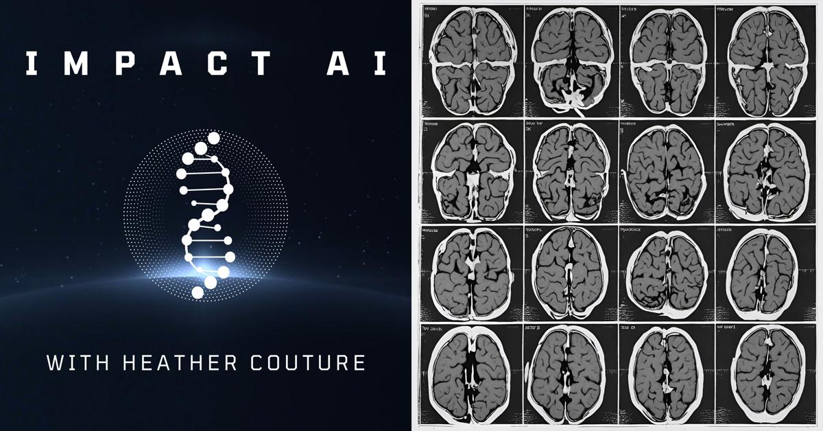 Measuring Neurological Conditions with Dirk Smeets from Icometrix