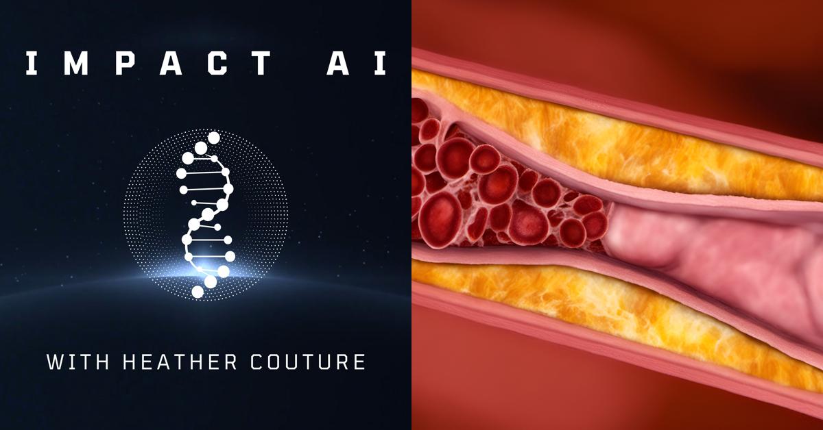 Preventing Heart Attacks and Strokes with Todd Villines from Elucid